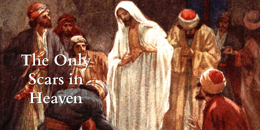 Bible Love Notes: Ugly Scars