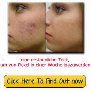 pickel schnell loswerden