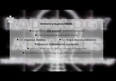 Radiology Archives: Μέτρηση της Οστικής Πυκνότητας με DEXA