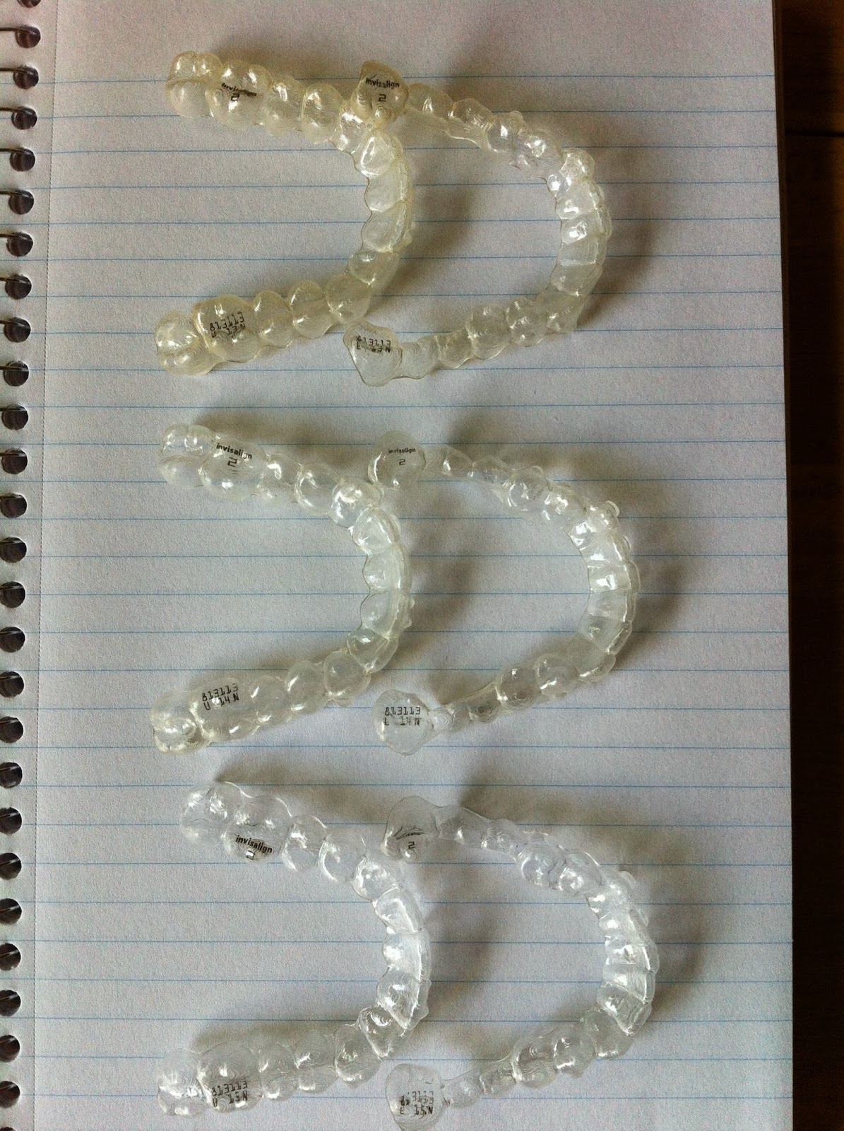 Michelle's Invisalign Journey: Tray 14