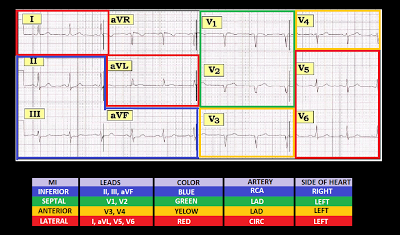 Paramedic Student Central: Locating an MI