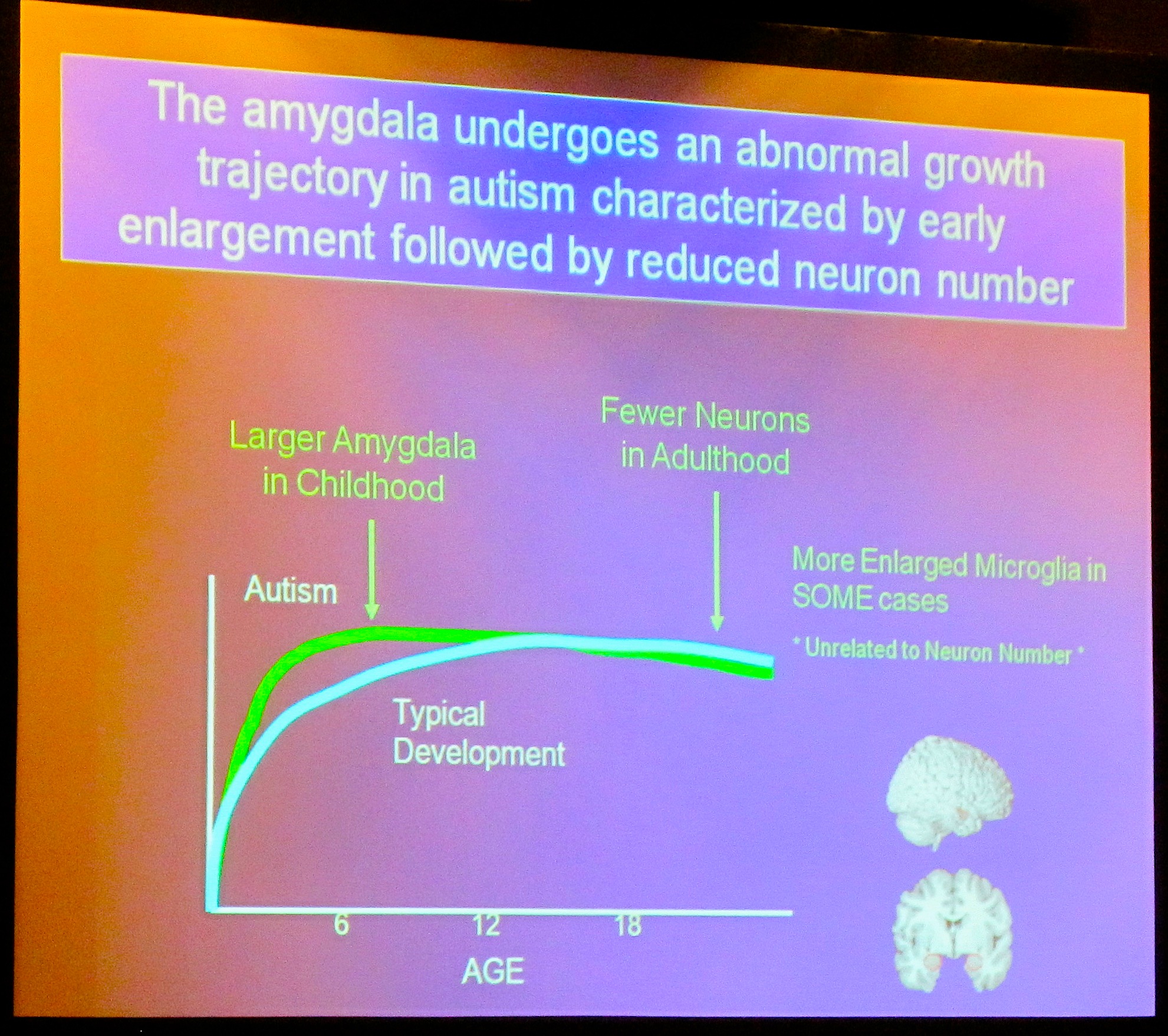 IMFAR 2011: Neuropathology of the Amygdala in Autism — THINKING PERSON ...