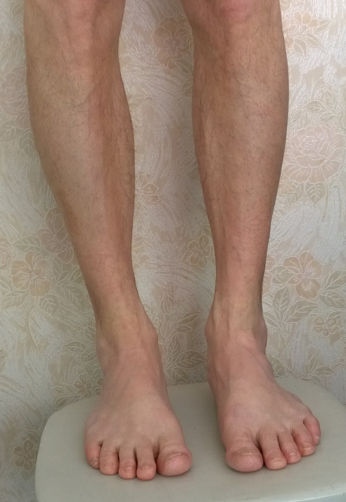 Kauneus blogi: JALKOJEN RAKENNEANALYYSI MIES 53V.