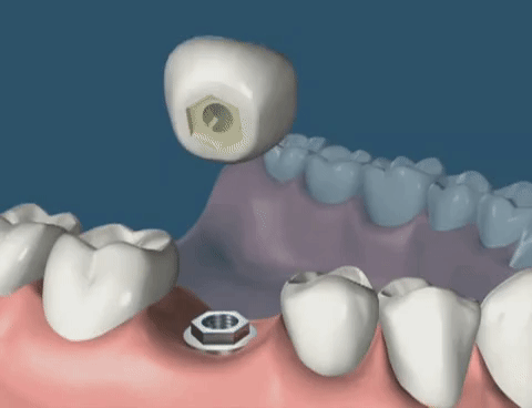 Servicios Odontológicos Health Dent