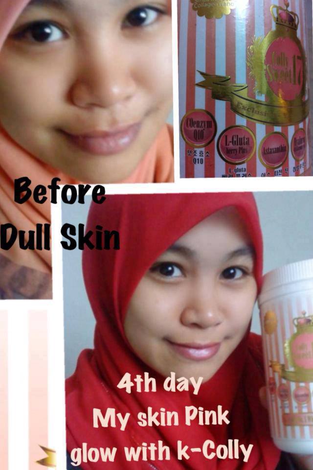 Online Supplement Shoppe - Pengedar Minyak Kelapa Dara Treenea: K-Colly ...