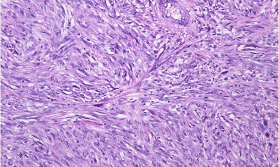 Dr Herry Setya Yudha Utama SpB. FInaCS. MHKes. ICS: ONCOLOGY ...