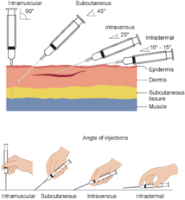 PHARMACODYNAMICS AND OPIOID | Yin