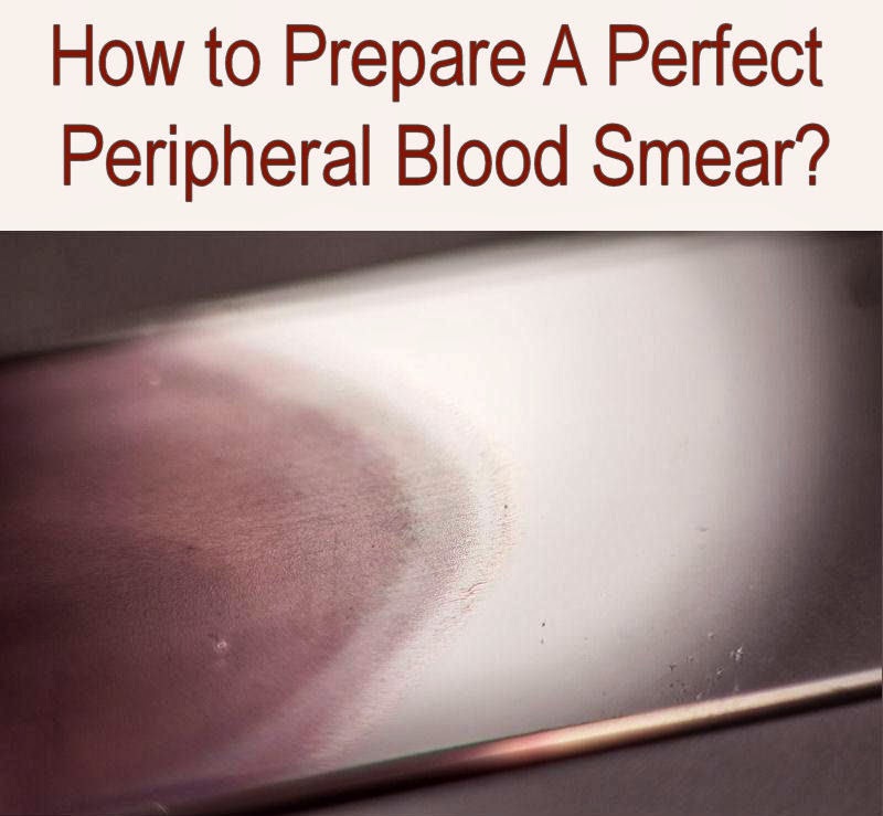 Medical Laboratory and Biomedical Science: How to Prepare a Perfect ...