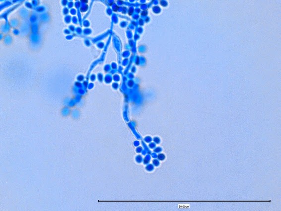 Fun With Microbiology (What's Buggin' You?): Sporothrix schenckii ...