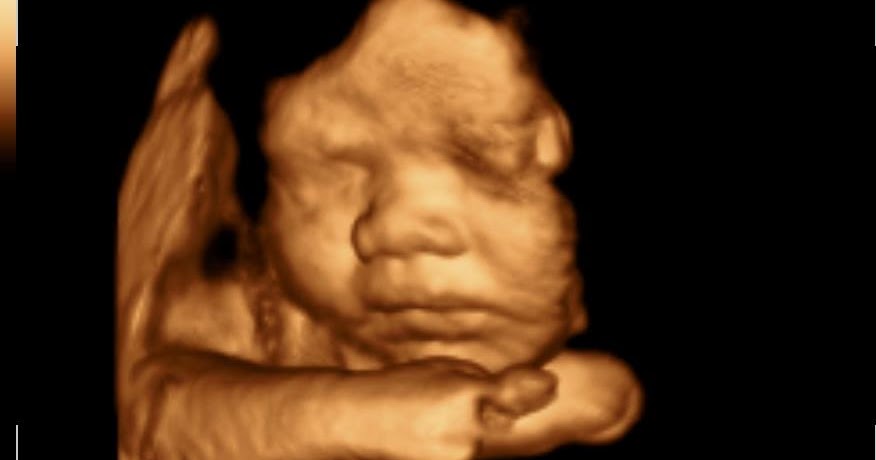 Growth scan vs Detail Scan vs 3D4D5D