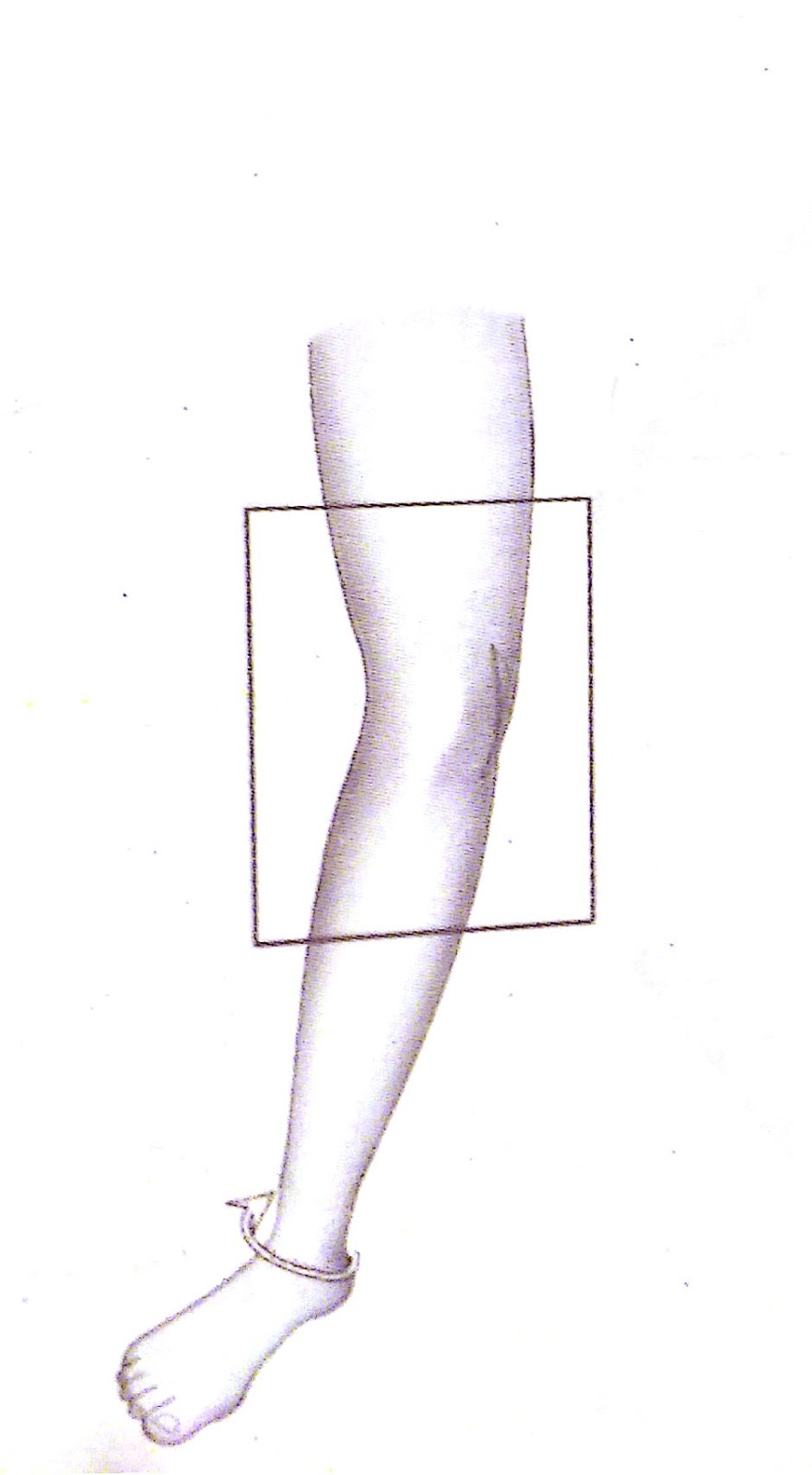 Laino Fisioterapia: Lesione legamento crociato anteriore: trattamento ...