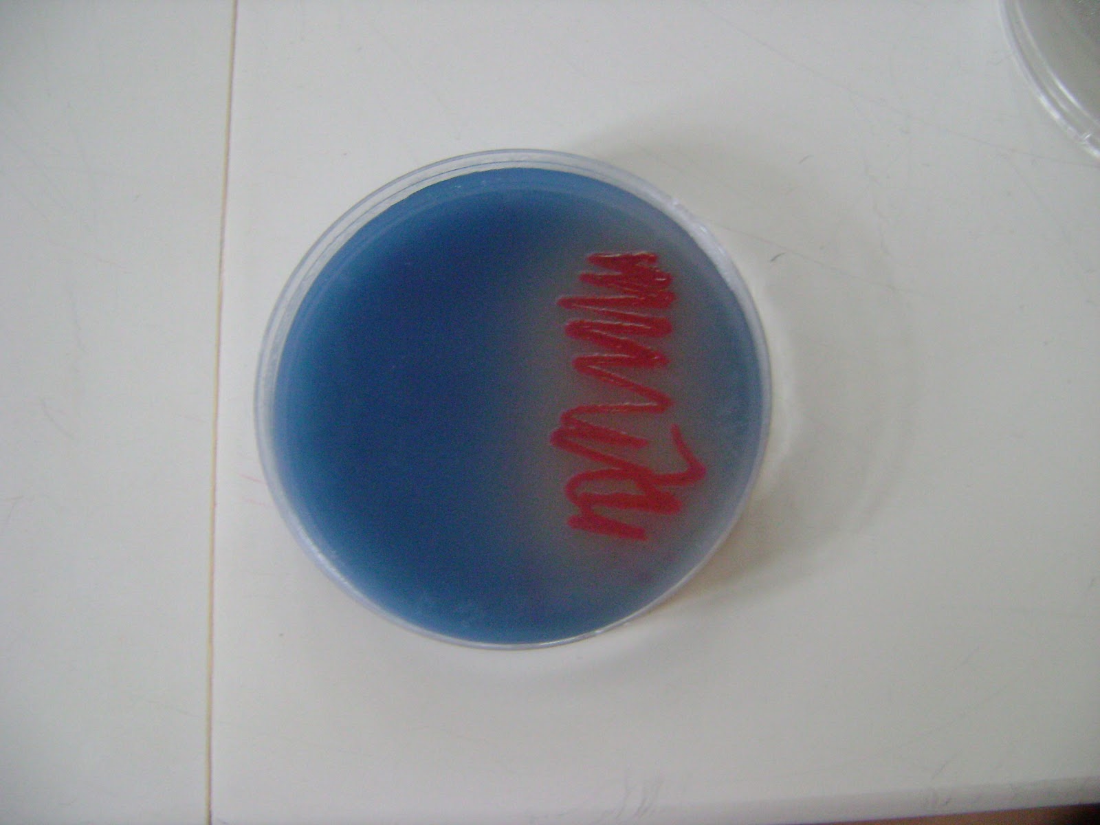 MedicALI Microbiology: Oxygen Utilization and the Digestive Enzyme Test