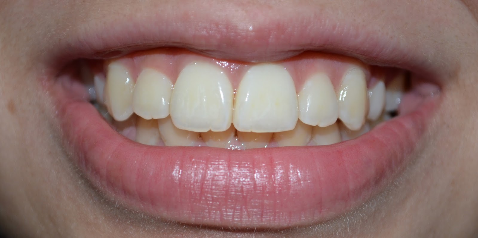 Probando y Comprobando: Probando y Comprobando tip natural para ...