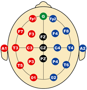 Insight, a growth project driven by tDCS: Cognitive enhancement montage ...