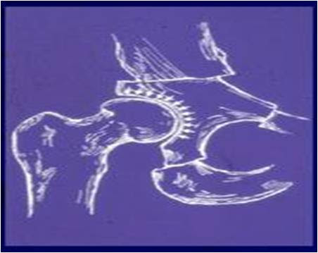 orthopedic chirugus: OSTEOTOMIES AROUND HIP