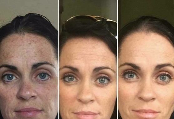 Look Younger With Facial Aerobics Exercises: Ultimate Non-Surgical ...