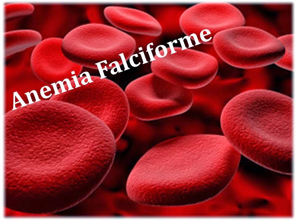 Anemia falciforme - Enfermagem bio