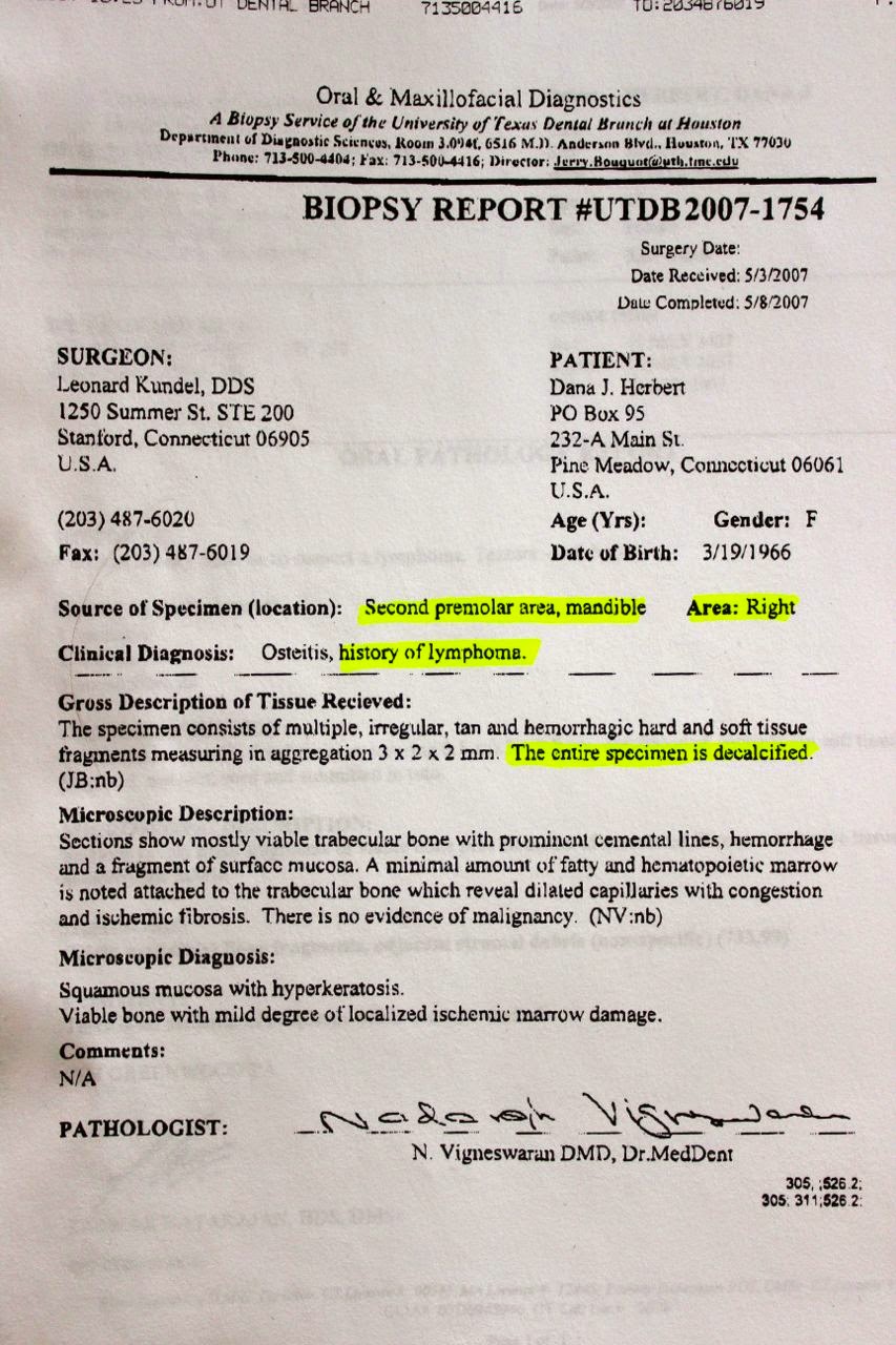 Dana Herbert: Dental Causes of Chronic Fatigue Syndrome