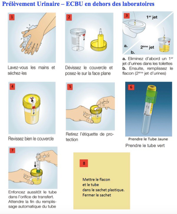 Examen cytobactériologique des urines - Pr.Laouar (Constantine) ~ COURS de la pharmacie
