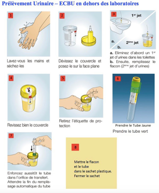 Examen cytobactériologique des urines - Pr.Laouar (Constantine) ~ COURS ...
