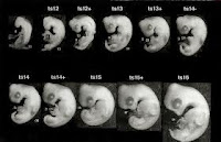 Janin Usia 120 Hari Saat Ruh Ditiupkan – Ilmu Waris & Keluarga