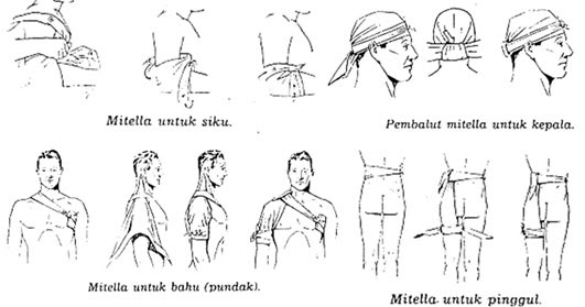 Info Jamur Kuping: Empat Cara Membalut Luka