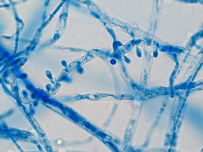 Fun With Microbiology (What's Buggin' You?): Trichophyton rubrum