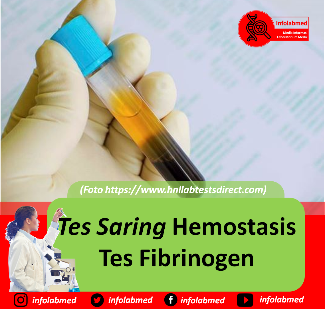 Tes Saring Hemostasis : Tes Fibrinogen