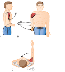 Sports Rehabilitation Services In Coimbatore | Orthopaedic Treatment ...