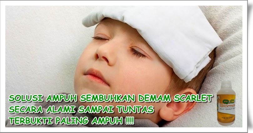Cara Menyembuhkan Demam Scarlet Secara Alami Sampai Tuntas 100% Efektif ...
