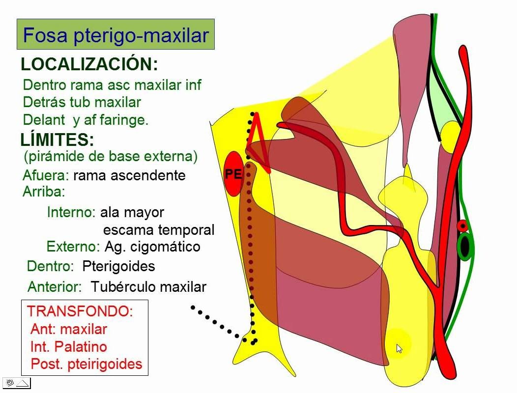 Diagnostico X: Fosa Pterigopalatina