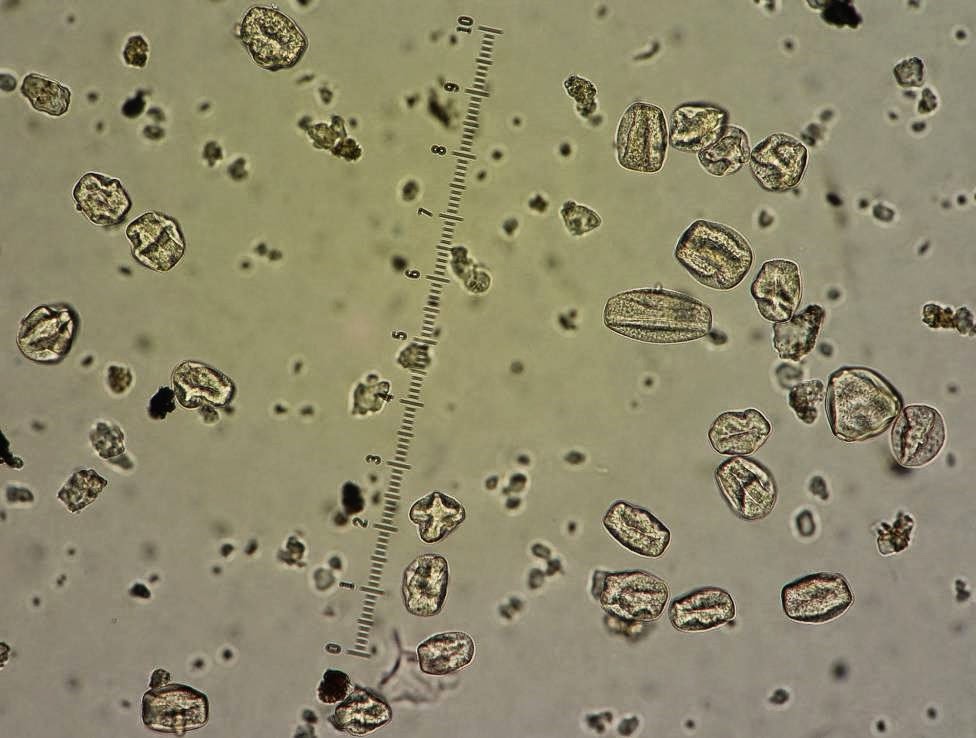 Sustainable Mycology: High Tree pollen counts in the midwest