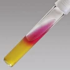 indah jayanti kumalasari: Uji Biokimia