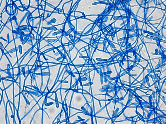 Fun With Microbiology (What's Buggin' You?): Epidermophyton floccosum