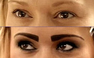 Skin is just the Beginning: The 'Scouse Brow'