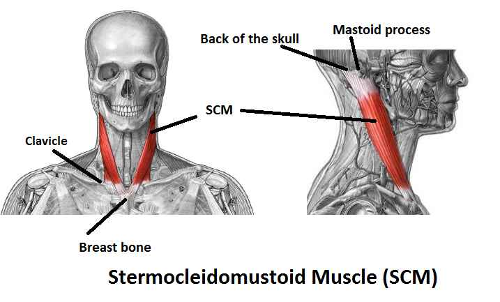 VASTRAL PHYSIOTHERAPY CLINIC: Torticollis And Physiotherapy Treatment ...