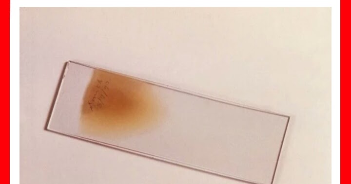 Edge Blood Smear: Definition and Function - SDN 1 BANCAR