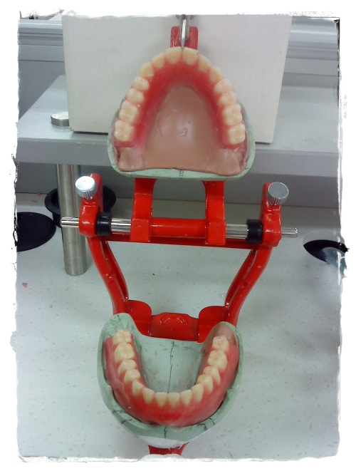 RetroAirplane-Fly Freely: denture teeth arrangement