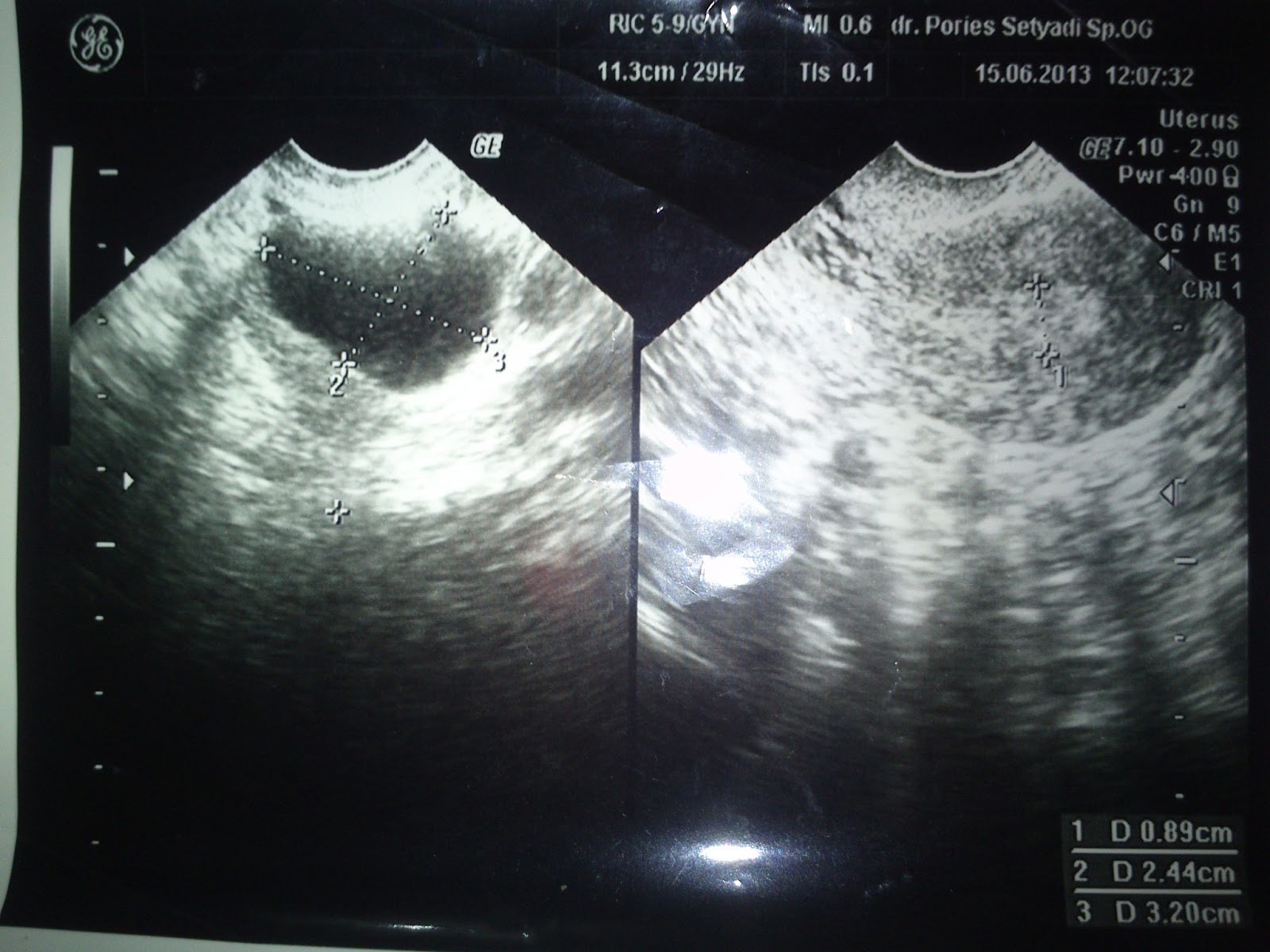 Our Journey: Ikhtiar dan doa : meet the doctor (dr. Pories setyadi, spog)