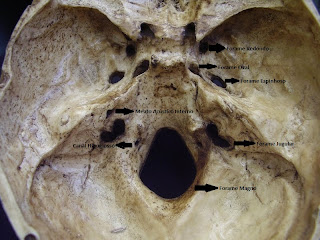 Anatomia Odontológica: Forames da Base do Crânio