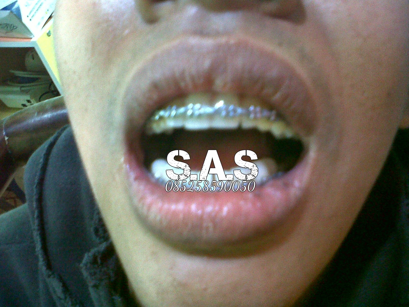 S.A.S - AHLI GIGI KOTA PATI, Jateng & KOTA JEMBER, Jatim: Tahap ...