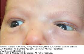 Dr.Joel Kyeremeh's Oculus