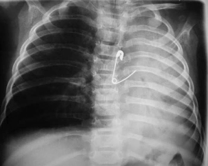 ESTUDIOS RADIOLÓGICOS EN PEDIATRÍA : PROYECCIONES Y POSICIONES RADIOLOGICAS