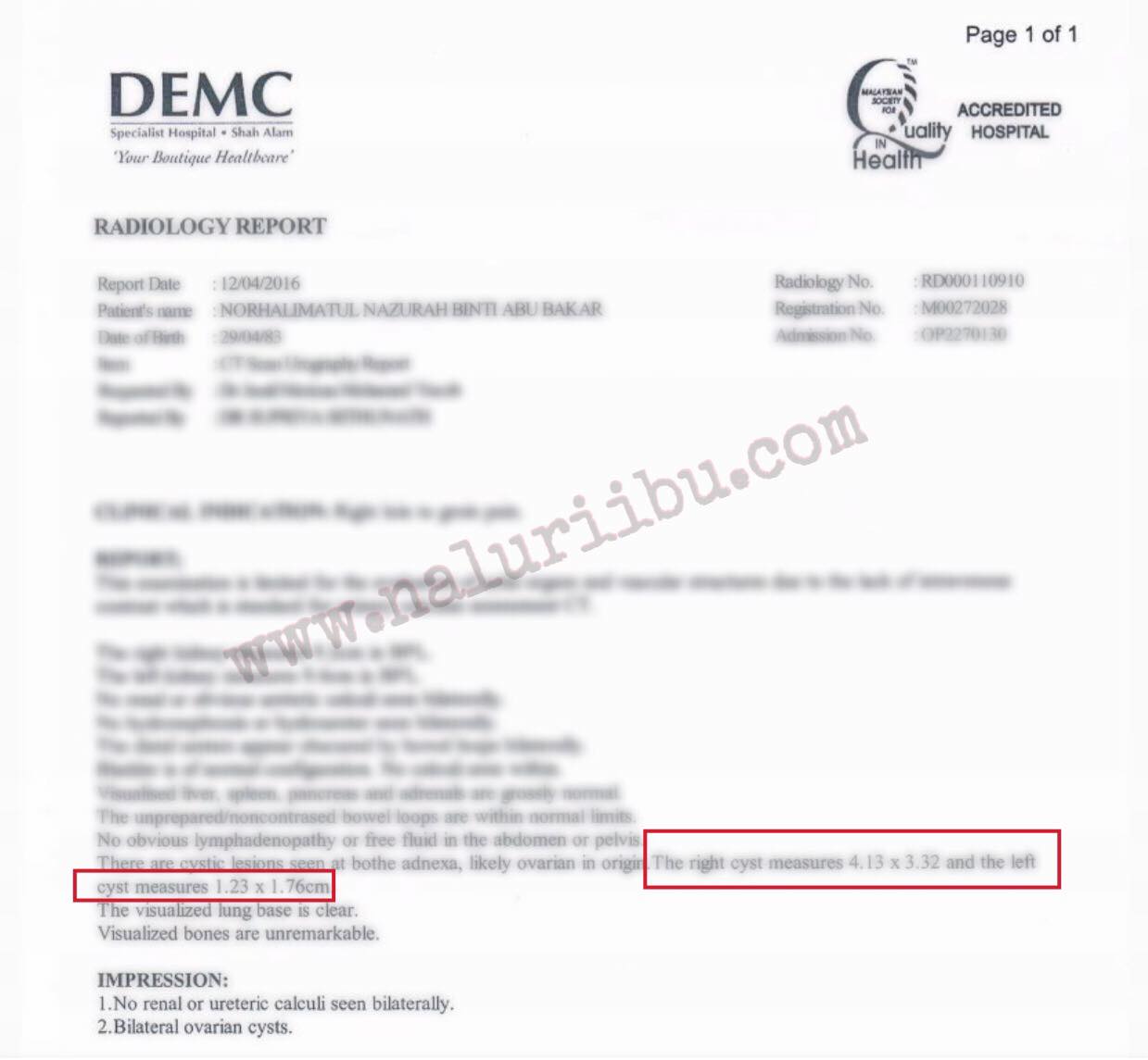 CYST KETIKA HAMIL, APA PATUT SAYA BUAT? - Jom Lebih Sihat!