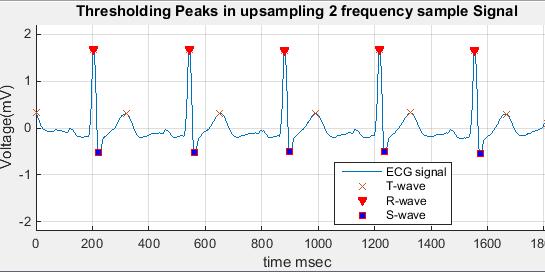 Biomedical Signal And Image Processing Projects Using Matlab And Labview Tools Matlab Code To