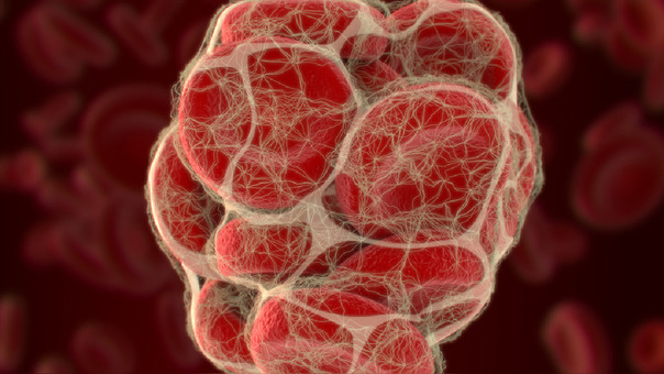 Elmer Huerta: "Un infarto pulmonar es más común de lo que uno piensa ...