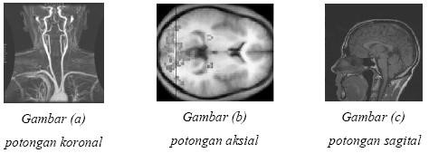 The Benefits of Medical Technology: Magnetic Resonance Imaging ( MRI )