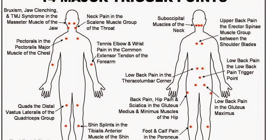 Family First Chiropractic and Wellness: What is Trigger Point Therapy?