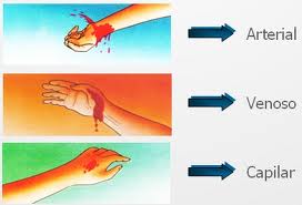 Blog Dr. Carlos: Hemorragias