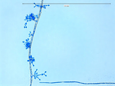 Fun With Microbiology (What's Buggin' You?): Fonsecaea pedrosoi/monophora